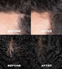 A3 Complex High-Intensity Hair Density Foam – XMONDO HAIR