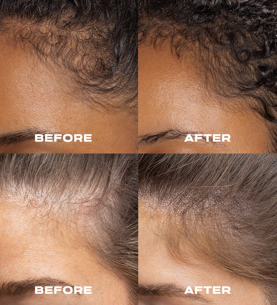 A3 Complex High-Intensity Hair Density Foam – XMONDO HAIR